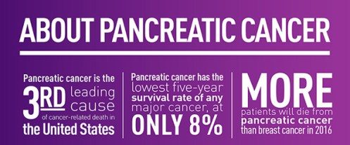 A Visual Guide to Understanding Pancreatic Cancer | Retiree News
